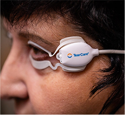 Dry Eye Treatment in Shreveport, LA | Lusk Eye Specialists